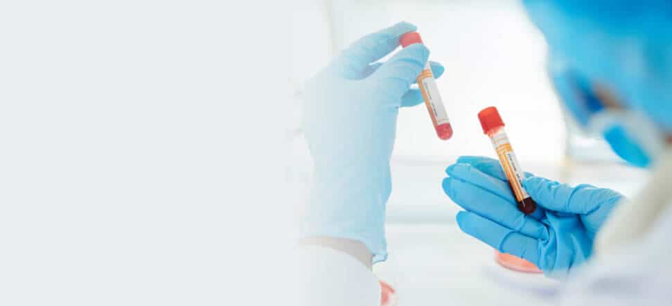 Blood Testing Services from Dr. J. E. Williams, OMD